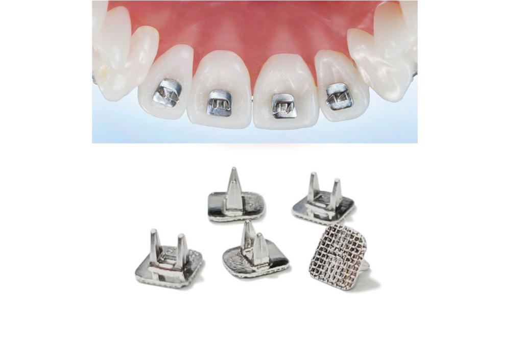 Tongue-Tamers – John Dental Supplies Inc