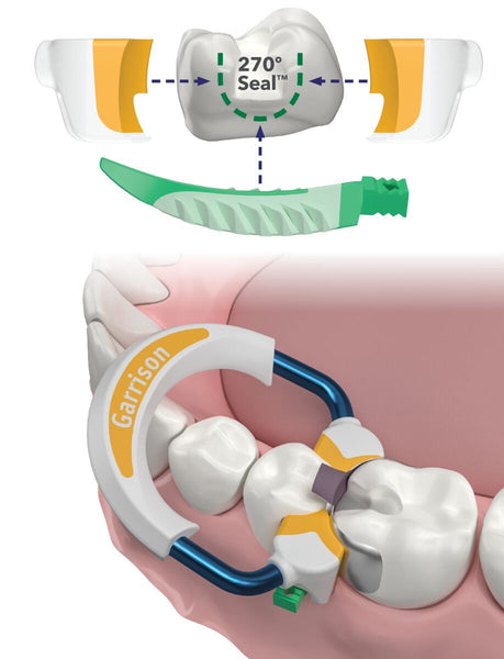 STRATA G MATRIX KIT – John Dental Supplies Inc