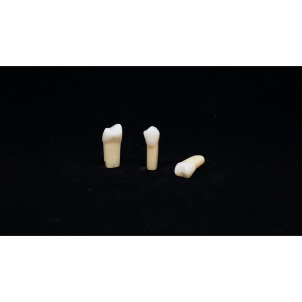 A27 #46X MOD Composite Resin Teeth with Caries Teeth – John Dental ...