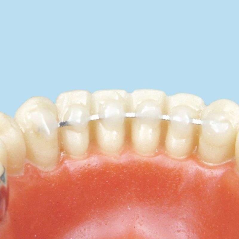 Retention wire – John Dental Supplies Inc